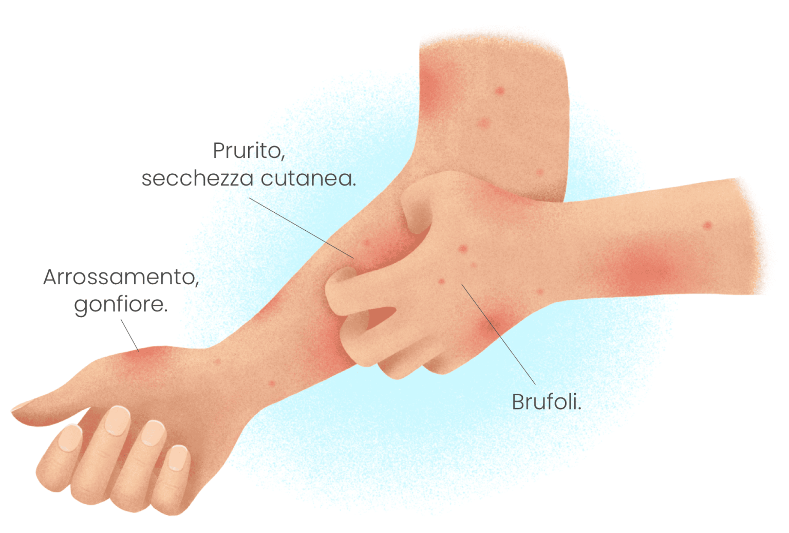 Allergie cutanee: allergici non si nasce, si diventa! - Yuka